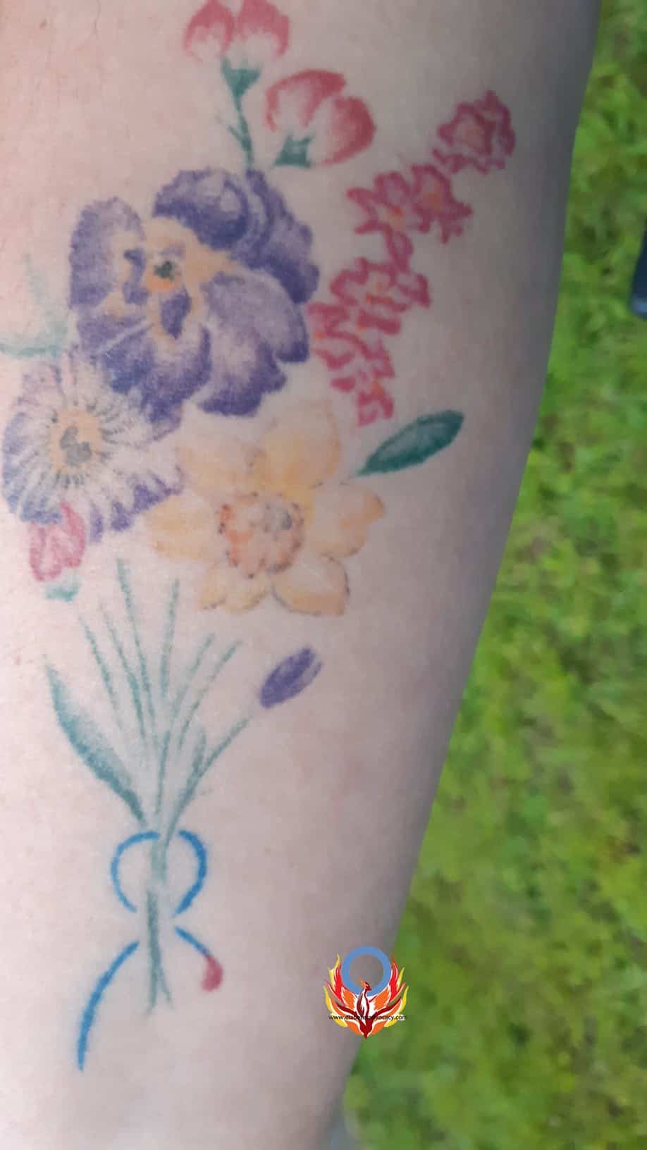 lynn Rae tattoo - Diabetes Advocacy